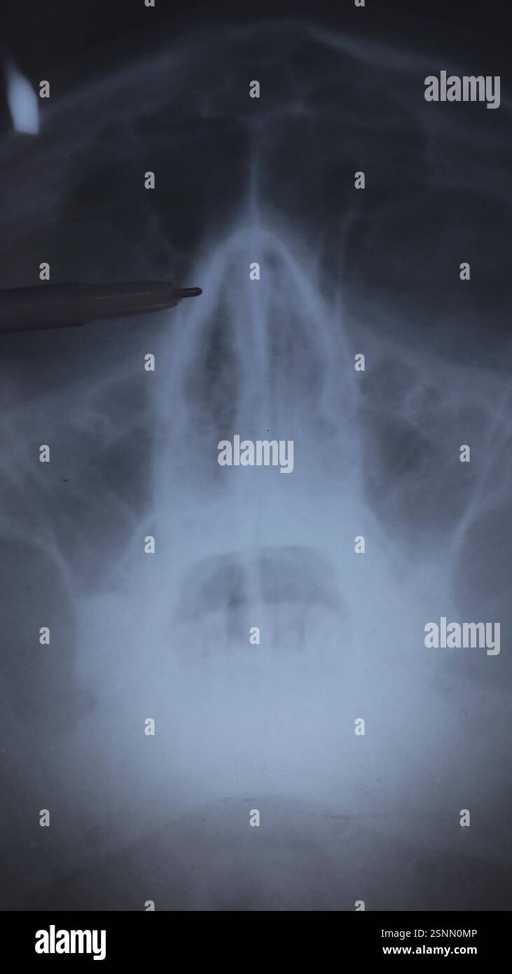 Doctor learning Vertical X-ray scan of a human skull Stock Video ...