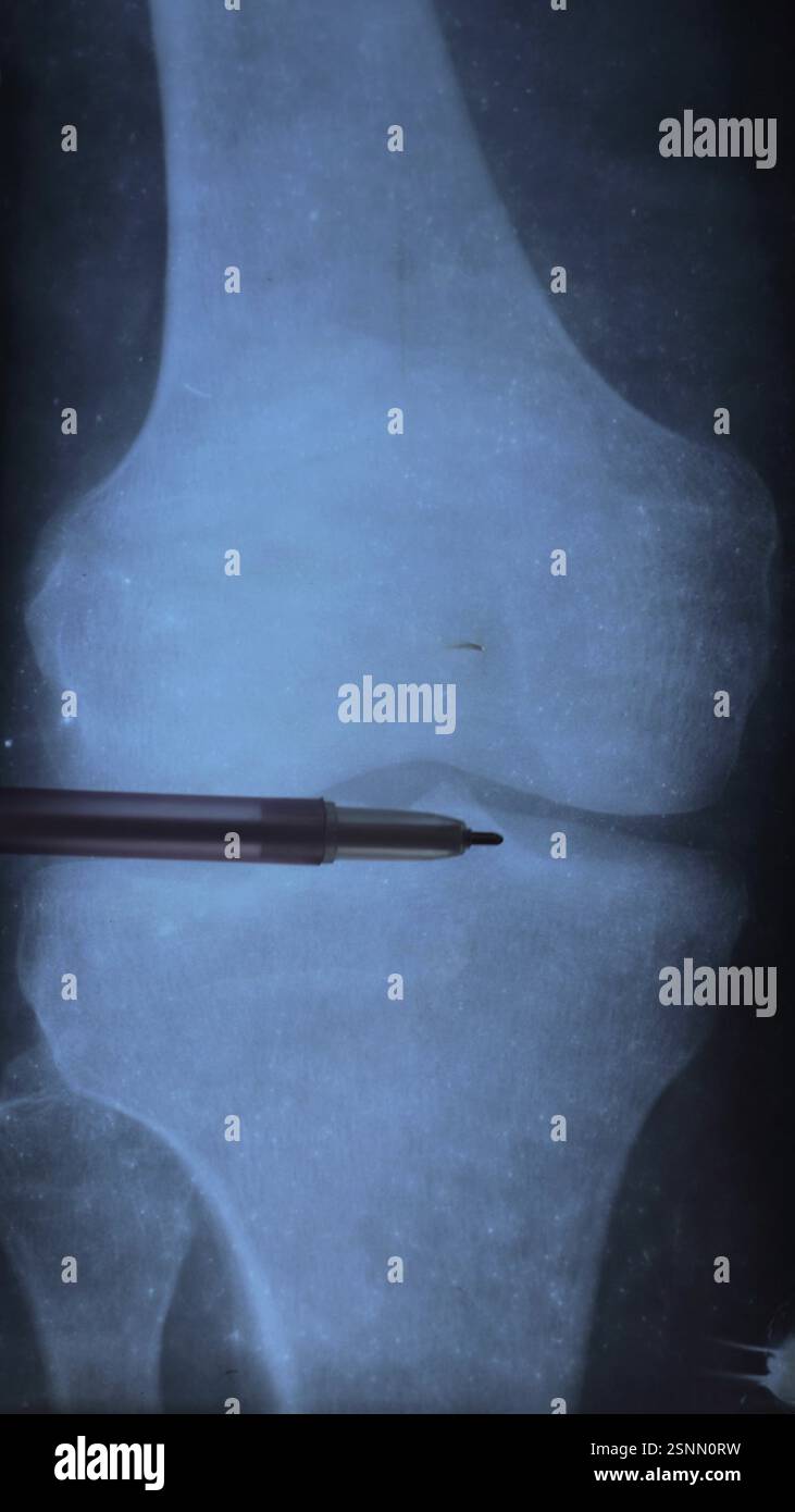 Diagnostic of Knee joint pathology Stock Video Footage - Alamy