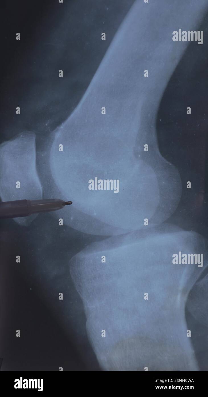 Doctor learn vertical X-ray or MRI scan of human kneecap Stock Video ...