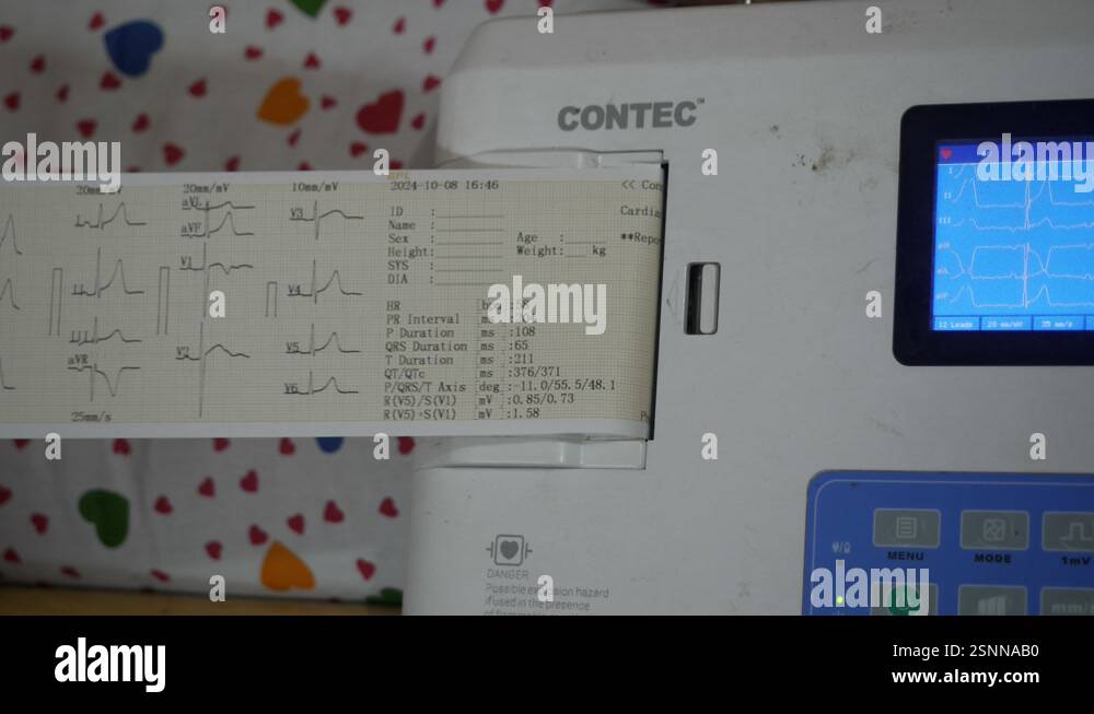 ECG machine display and print out chart indicating heart's electrical ...