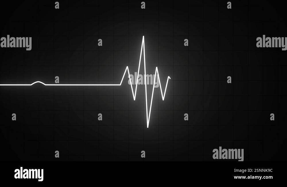 White neon Heart pulse monitor with signal. Heartbeat line. Flat line ...