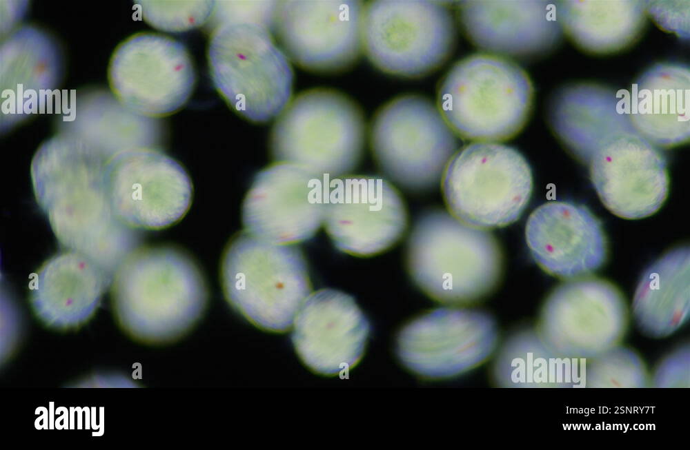 Larvae of a polychaete worm Phyllodoce sp. at trochophore stage under ...