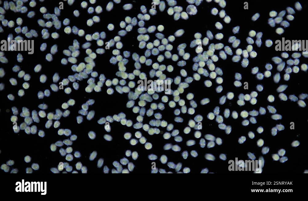 Larvae of a polychaete worm Phyllodoce sp. at trochophore stage under ...