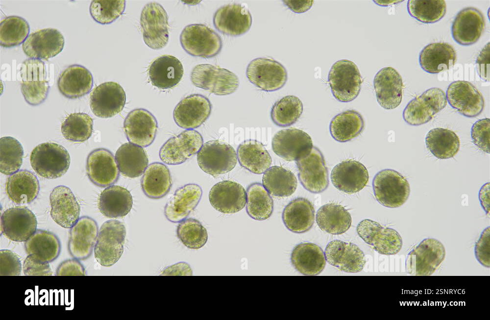 Larvae of a polychaete worm Phyllodoce sp. at trochophore stage under ...