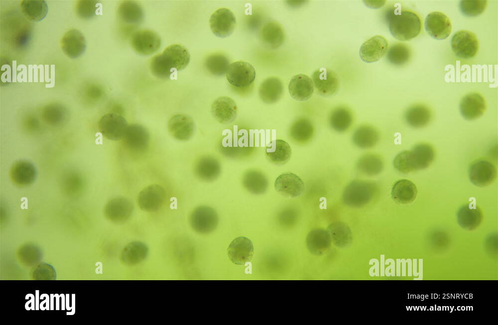 Larvae of a polychaete worm Phyllodoce sp. at trochophore stage under ...