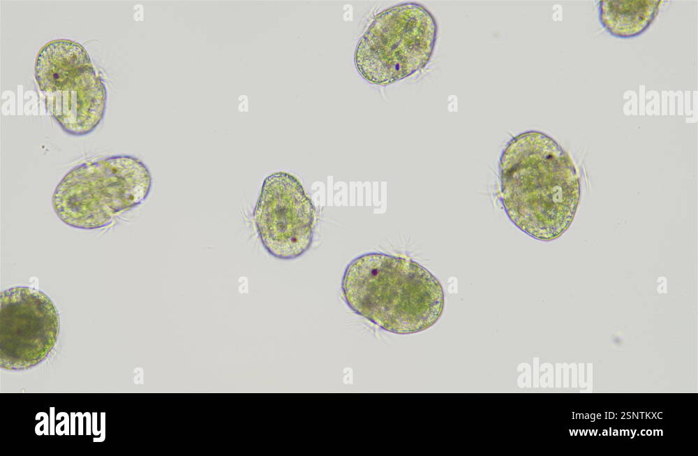 Larvae of a polychaete worm Phyllodoce sp. at trochophore stage under ...