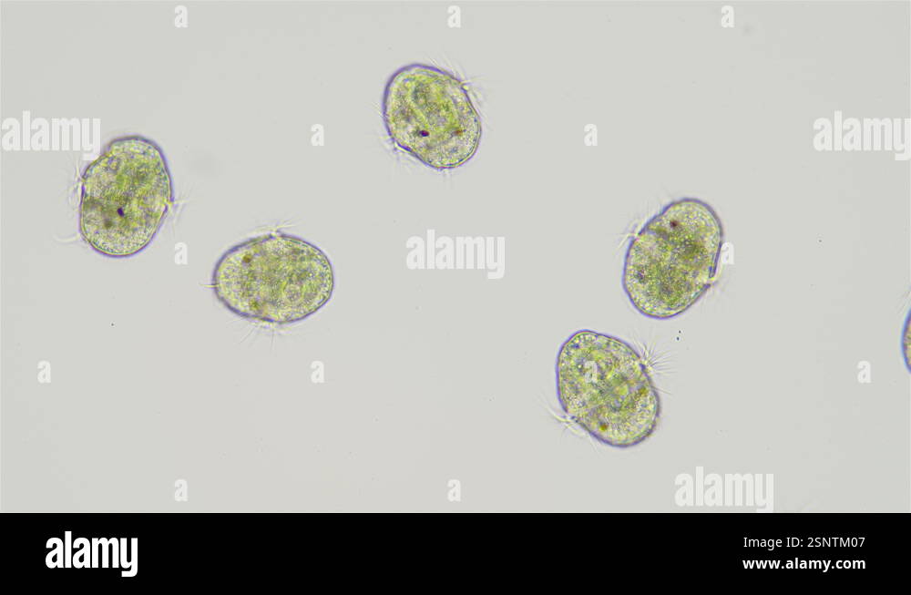 Larvae of a polychaete worm Phyllodoce sp. at trochophore stage under ...