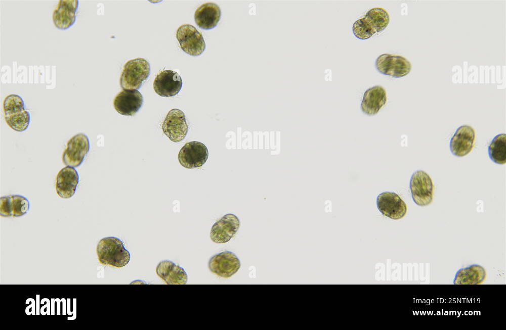 Larvae of a polychaete worm Phyllodoce sp. at trochophore stage under ...