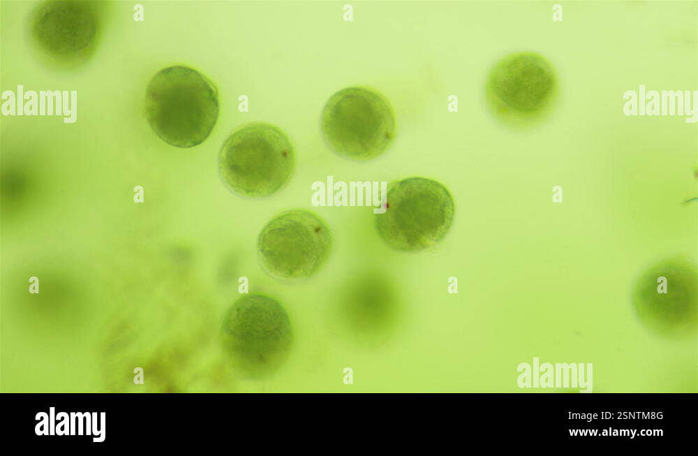 Larvae of a polychaete worm Phyllodoce sp. at trochophore stage under ...