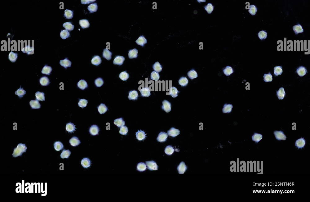 Larvae of a polychaete worm Phyllodoce sp. at trochophore stage under ...