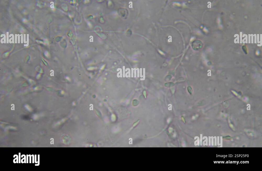 Live human sperm (spermatozoa motion). Image real of a biological ...