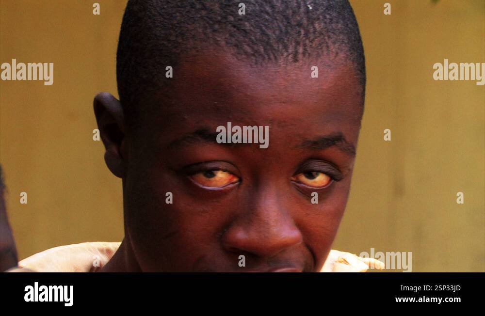 Blind man africa Stock Videos & Footage - HD and 4K Video Clips - Alamy
