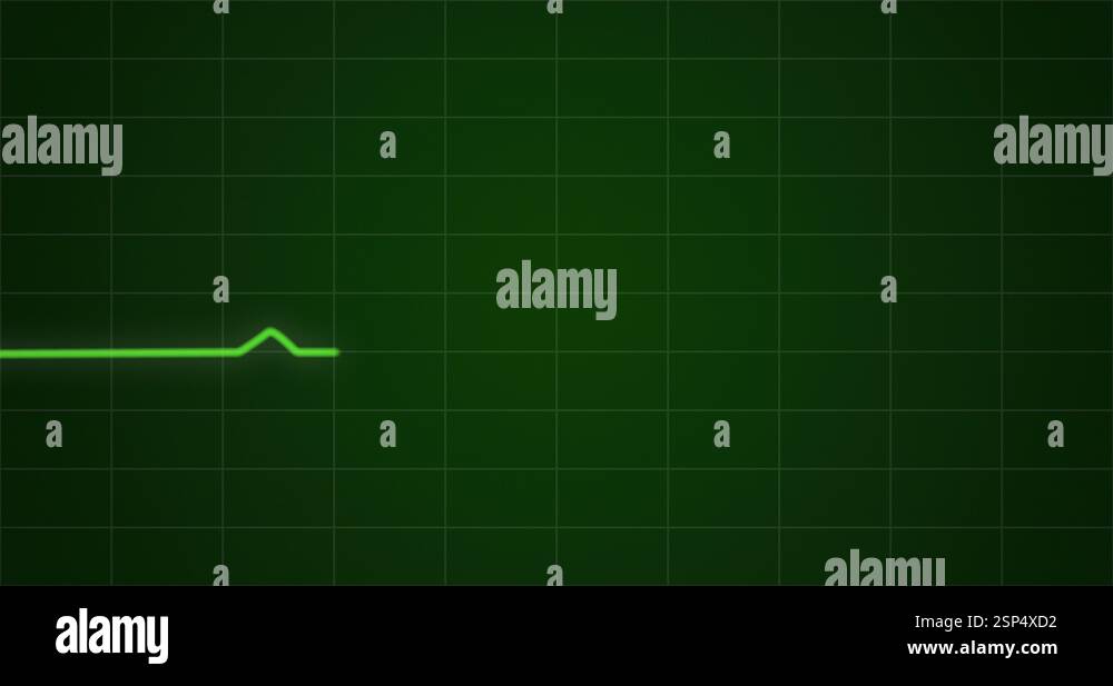 Digital ECG or EKG Monitor Stock Video Footage - Alamy