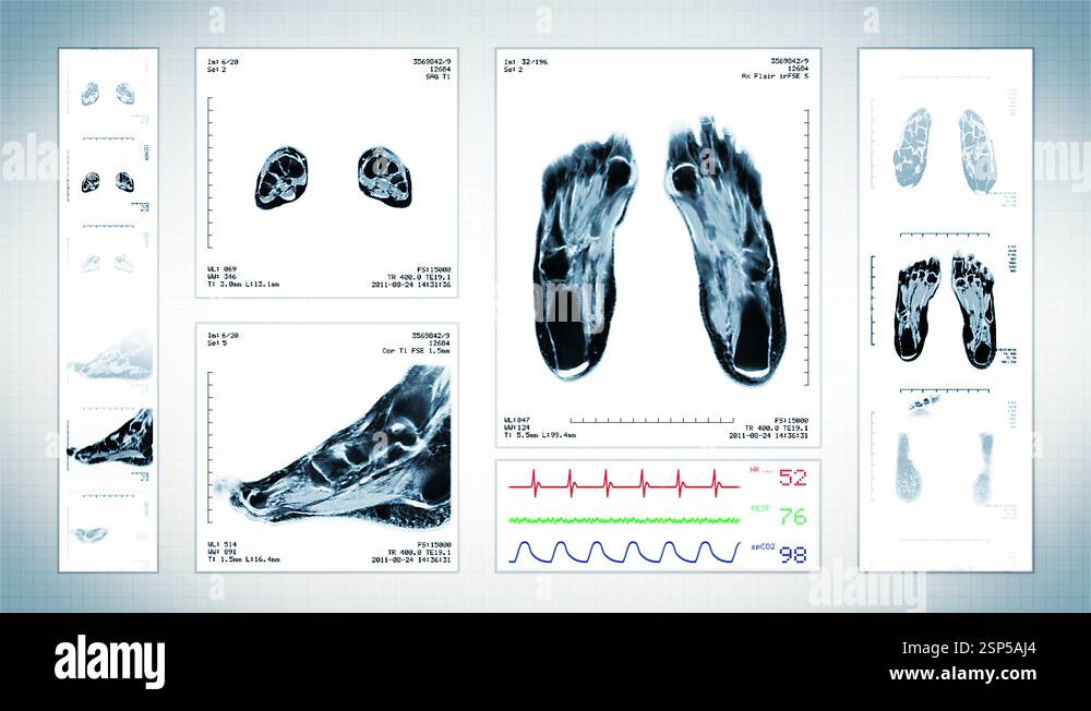 Foot MRI Scan. White. 3 in 1. Top, front, lateral view and ECG display ...