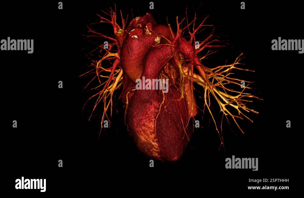 3D reconstruction of a CT scan of a beating human heart Stock Video ...