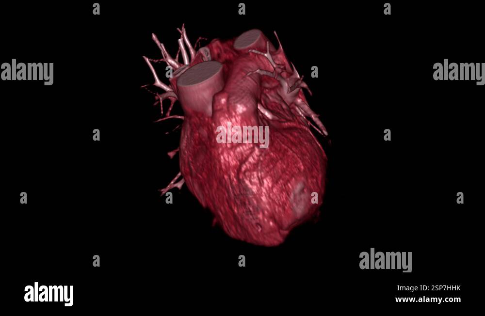3D CT scan reconstructions showing a beating human heart Stock Video ...