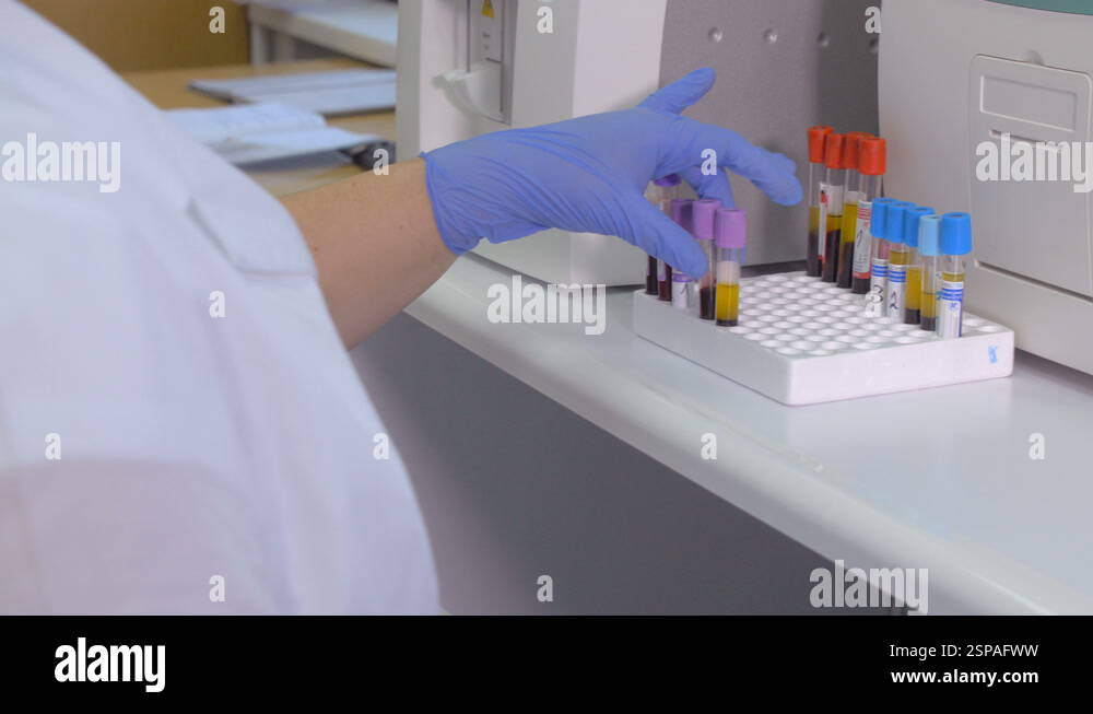 Lab technician operating test tubes, testing blood samples in ...