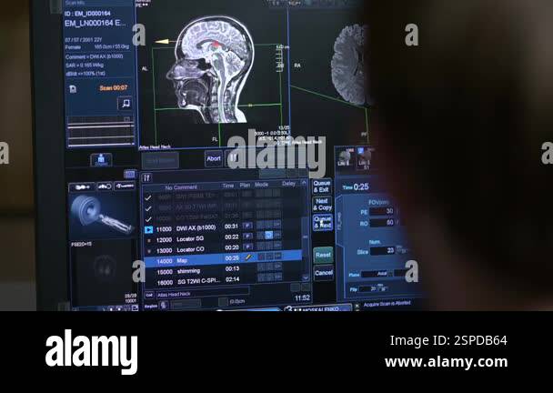 Imaging analysis software Stock Videos & Footage - HD and 4K Video ...