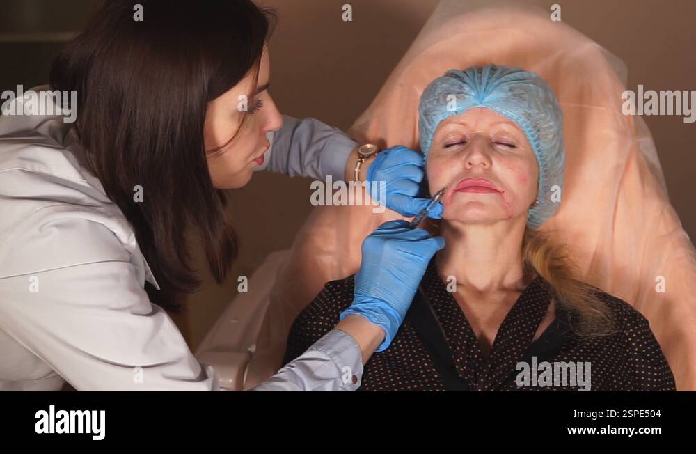 Thw doctor makes the final injections with Botox to remove nasolabial ...