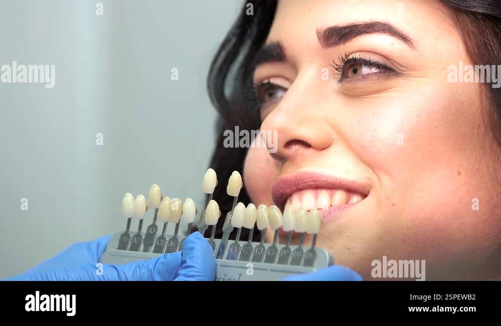 Patient and tooth color chart Stock Video Footage - Alamy