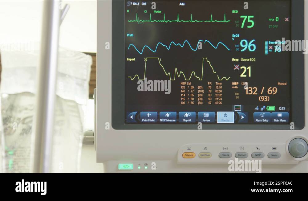 IV bag, vital signs monitor in a hospital, with pulse, blood pressure ...