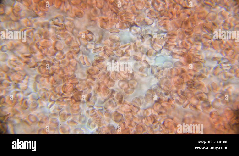 Flowing Red Blood Cells under Microscope - high magnification Stock ...