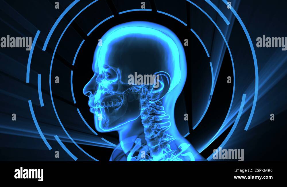 3D Animation of Adult Male Head X-Ray With Seamless Loop Stock Video ...