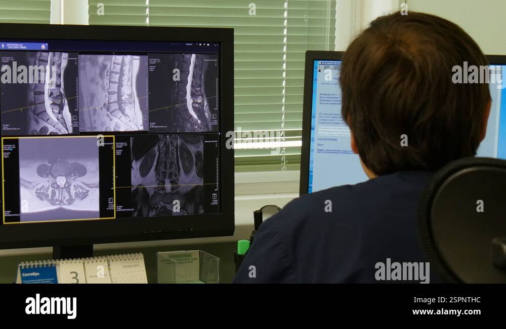 Doctor makes spinal cord and spinal column tomography on MRI scan Stock ...