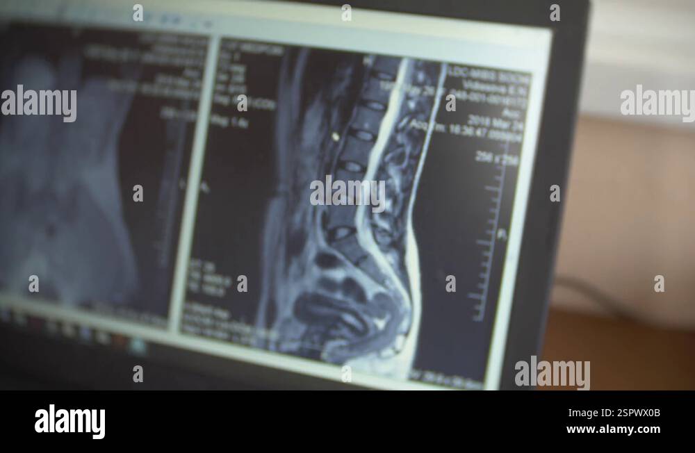 Doctor looking at computer screen while patient moving in mri machine ...