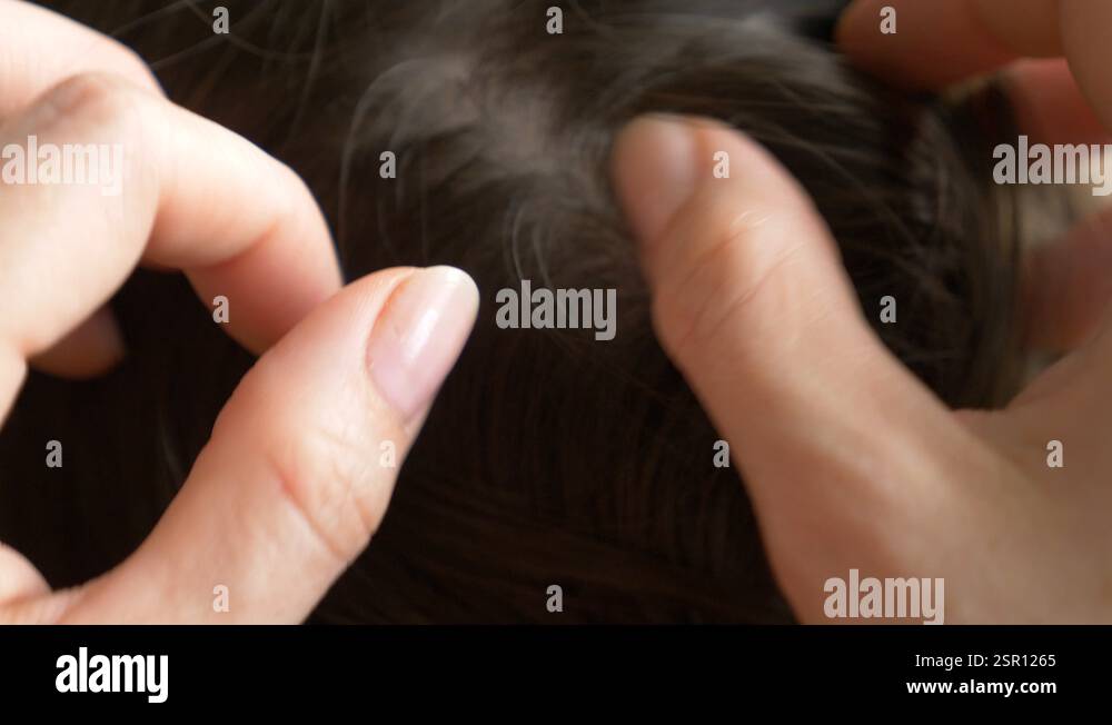 Close-up. 4k, slow motion. female hands, finding lice on heads with ...