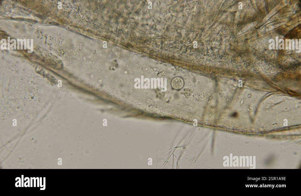 in the body of dead Daphnia parasites formed: Tetrahymena, spirochetes ...