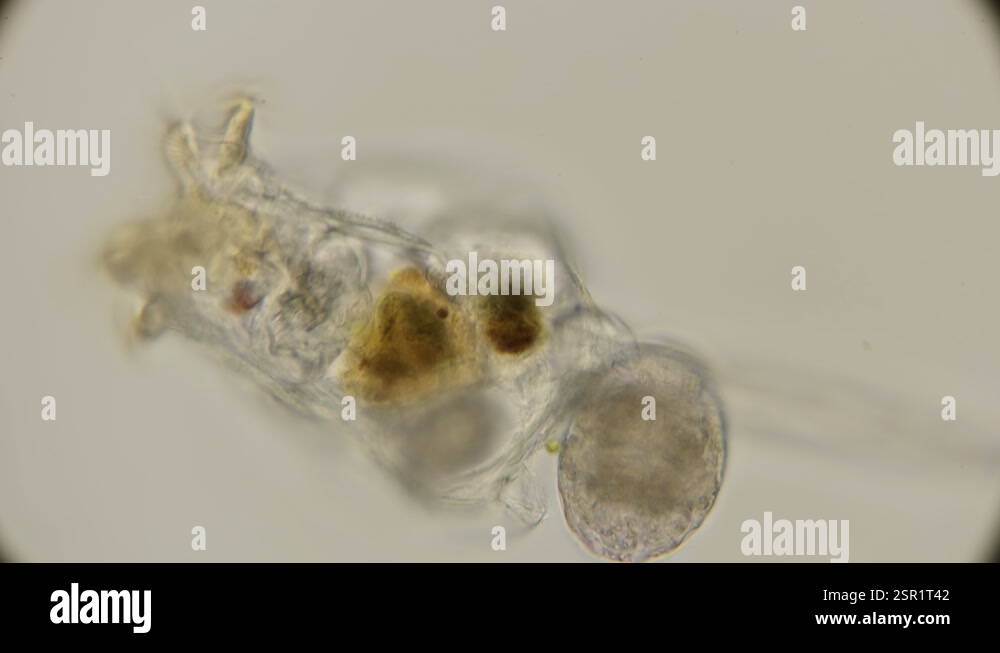 the rotifer Brachionus plicatilis with eggs, you can see all the ...
