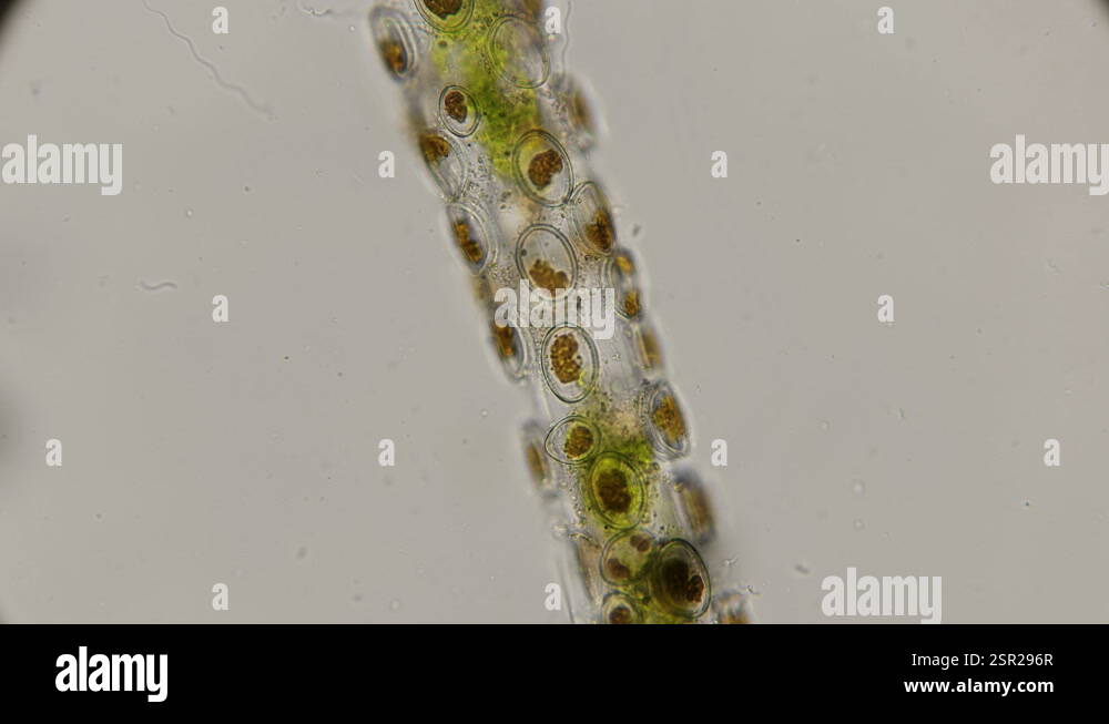 diatoms Cocconeis fixed on filamentous algae, under a microscope Stock ...