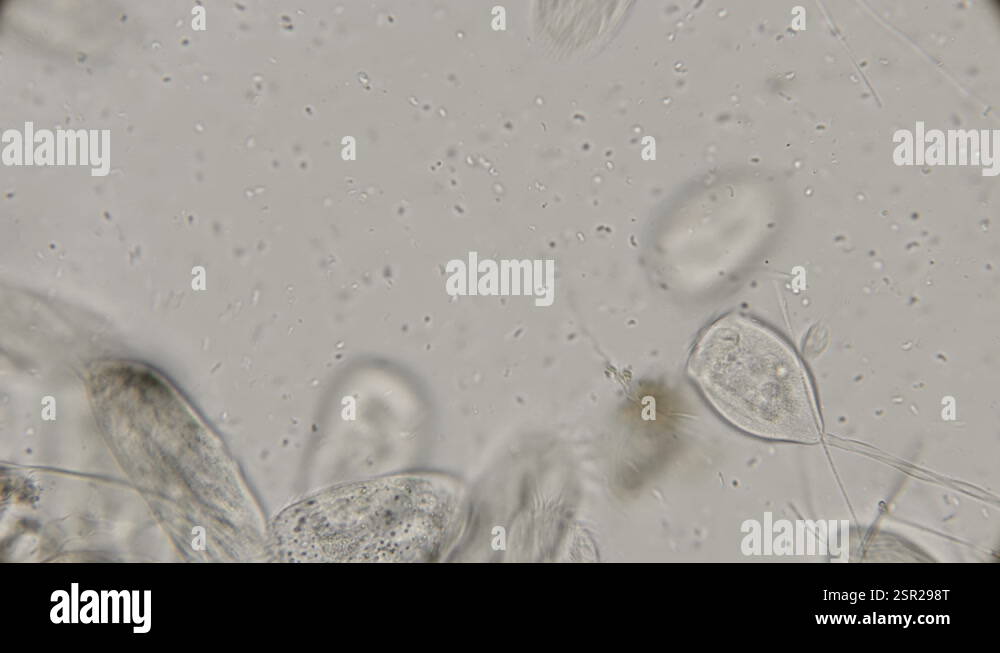a colony of ciliates Stylonychia and vorticella under microscope Stock ...