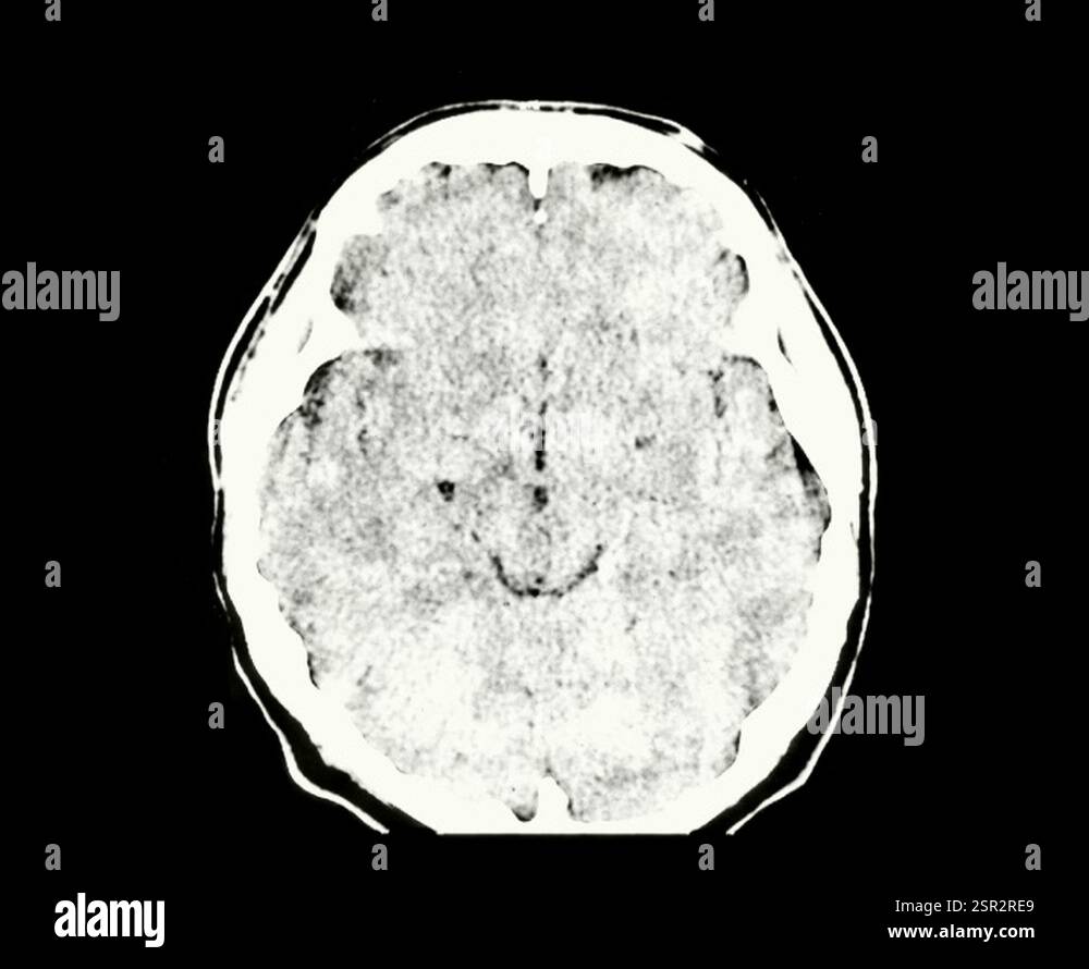 Ct scan eyes Stock Videos & Footage - HD and 4K Video Clips - Alamy