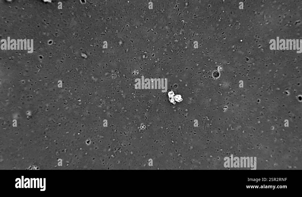 a drop of dirty water with a lot of bacteria and microorganisms, under ...