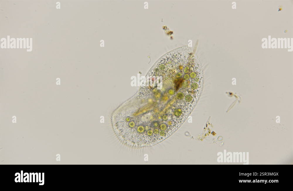Infusoria Kerona polyporum, which is a commensal and lives on the body ...