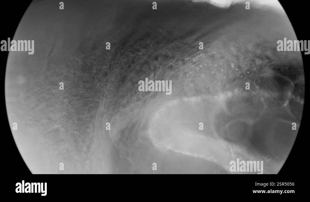 contraction and heartbeat of the cochlea embryo, under a microscope ...