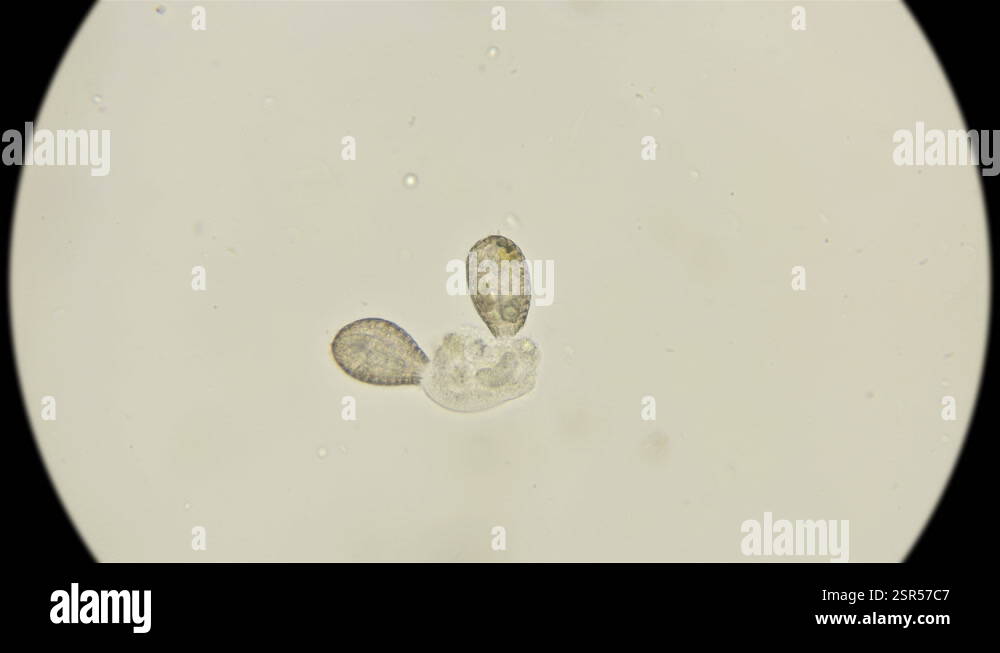 infusoria Coleps, class Ciliata, tear apart organic remains of a dead ...