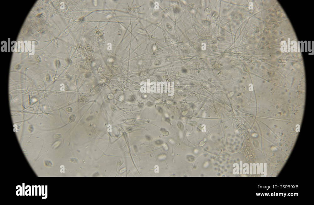 a drop of dirty water with a lot of bacteria and microorganisms, under ...