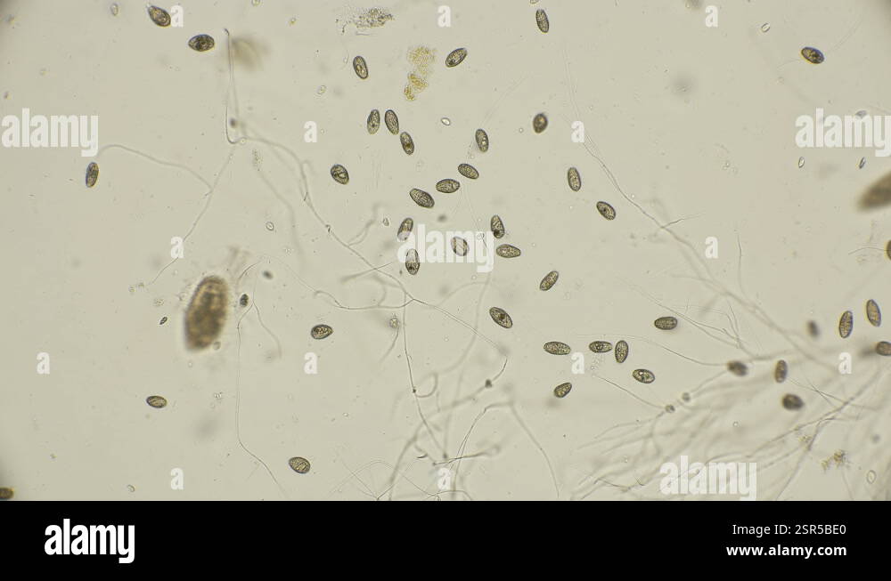 dead colony of the ciliates of the coleps, which are largely in dirty ...