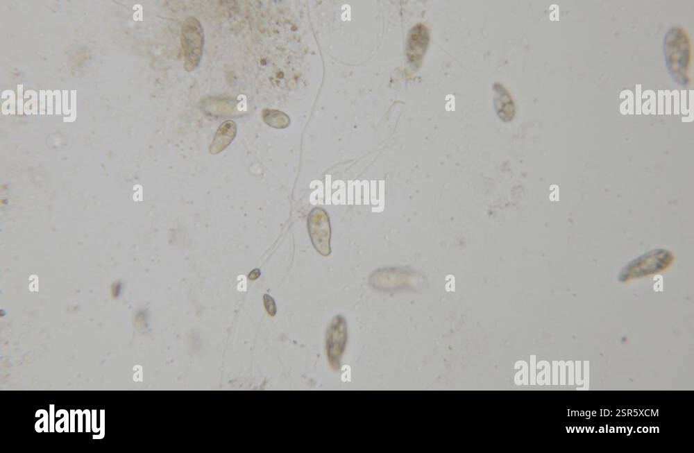 Motion of single-celled animals (infusoria) under microscope. Colony of ...