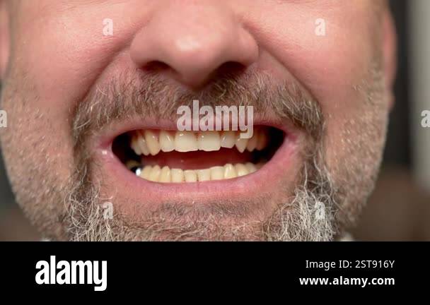 Man with mouth open and teeth visible moving jaw. Male with open mouth ...