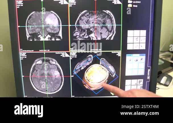 Film mri Stock Videos & Footage - HD and 4K Video Clips - Alamy