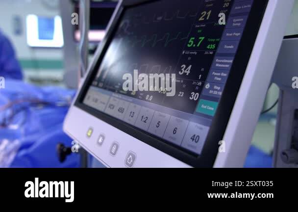 Monitor of the modern lung ventilating machine. Equipment displays life signs of the patient ...