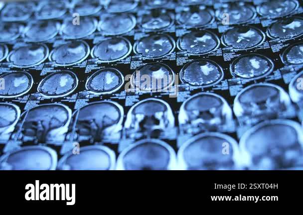 Head scans in diversity of positions. Checking the brain mri shots ...