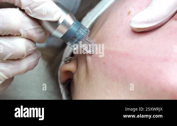Dermal pigmentation Stock Videos & Footage - HD and 4K Video Clips - Alamy