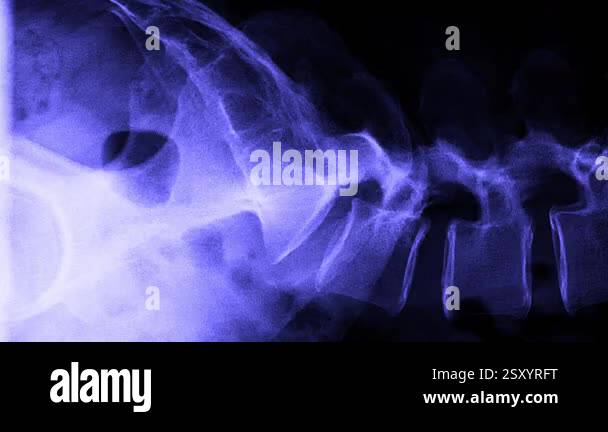 MRI scan timelapse of various sides human body, spine, coccyx bones ...