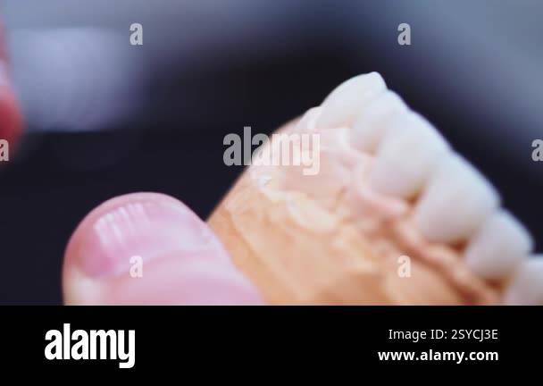 Man dentist hands setting dental tooth crown on jaw model working on ...