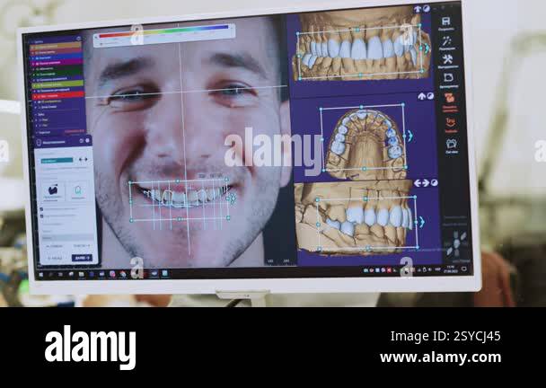 An advanced imaging system designed to capture detailed dental images ...
